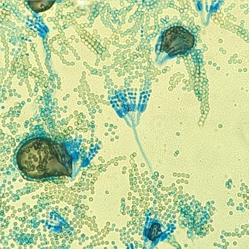 An Intro to Mold and Microscopic Mold Identification!