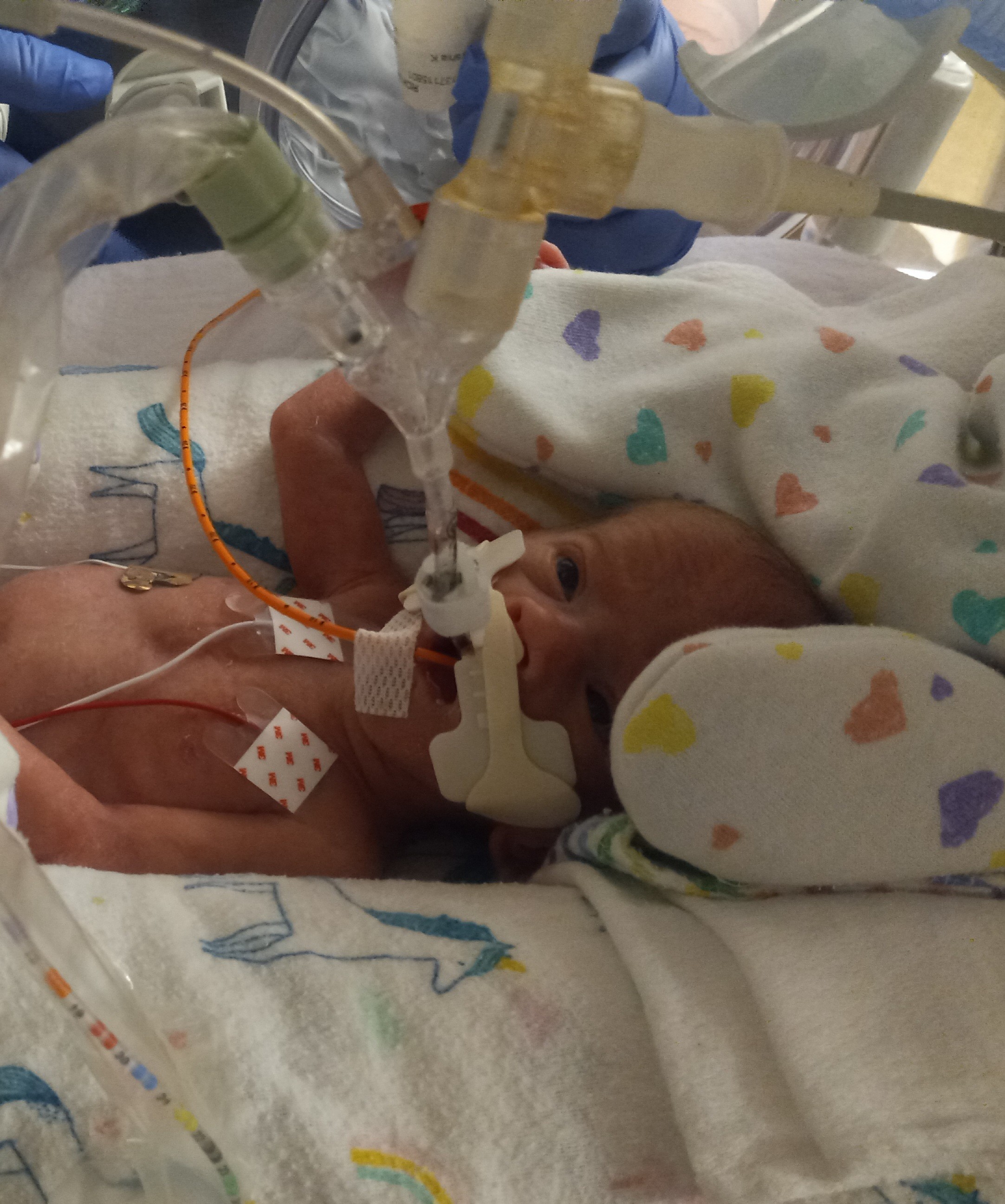 Fundraising for Dustee